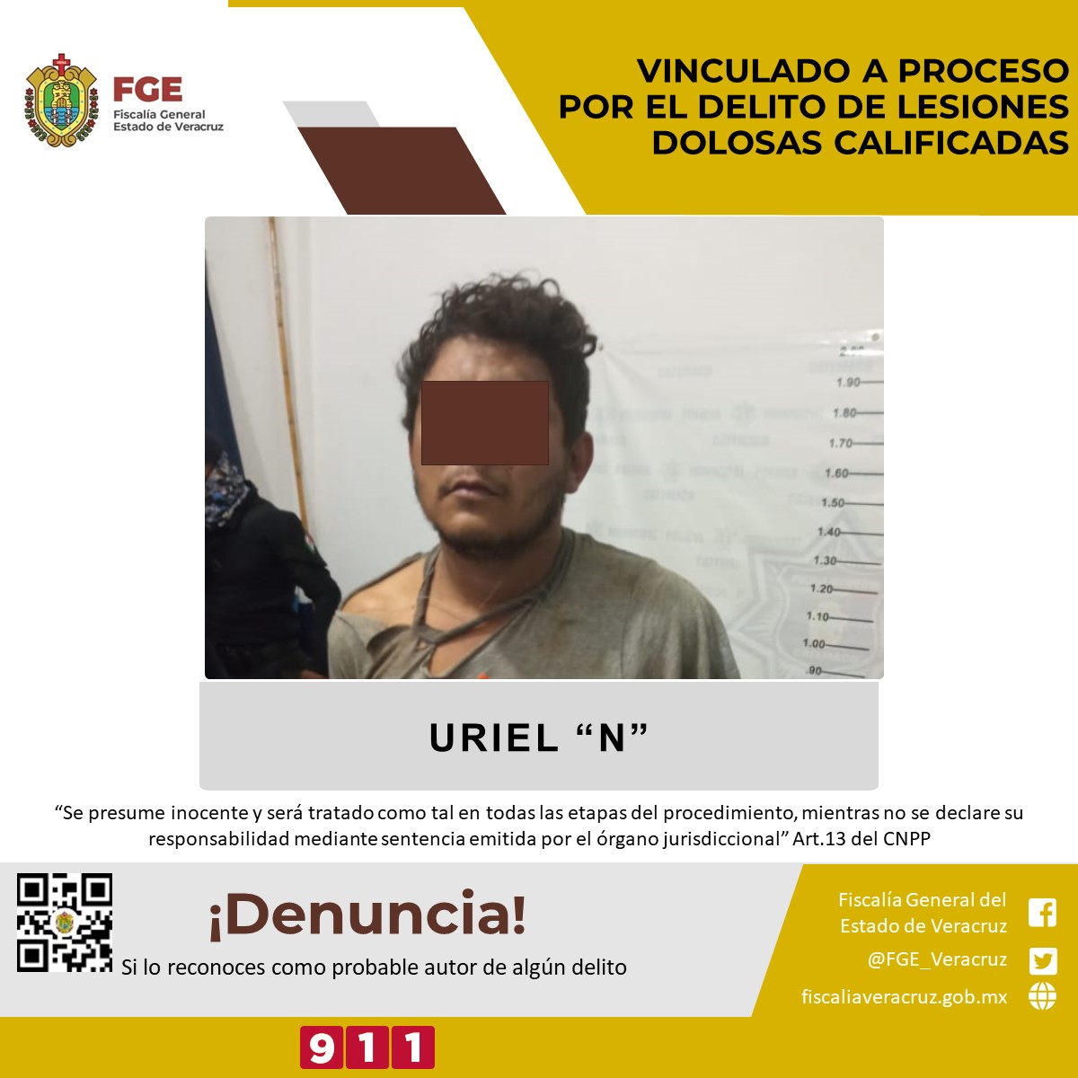 Se Obtiene Vinculación A Proceso Por Presunto Delito De Lesiones